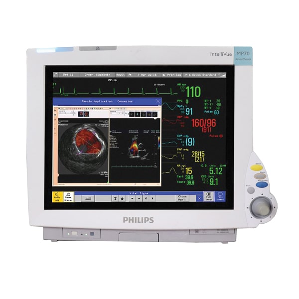 Heart Monitor Rental at Louise Mcmakin blog